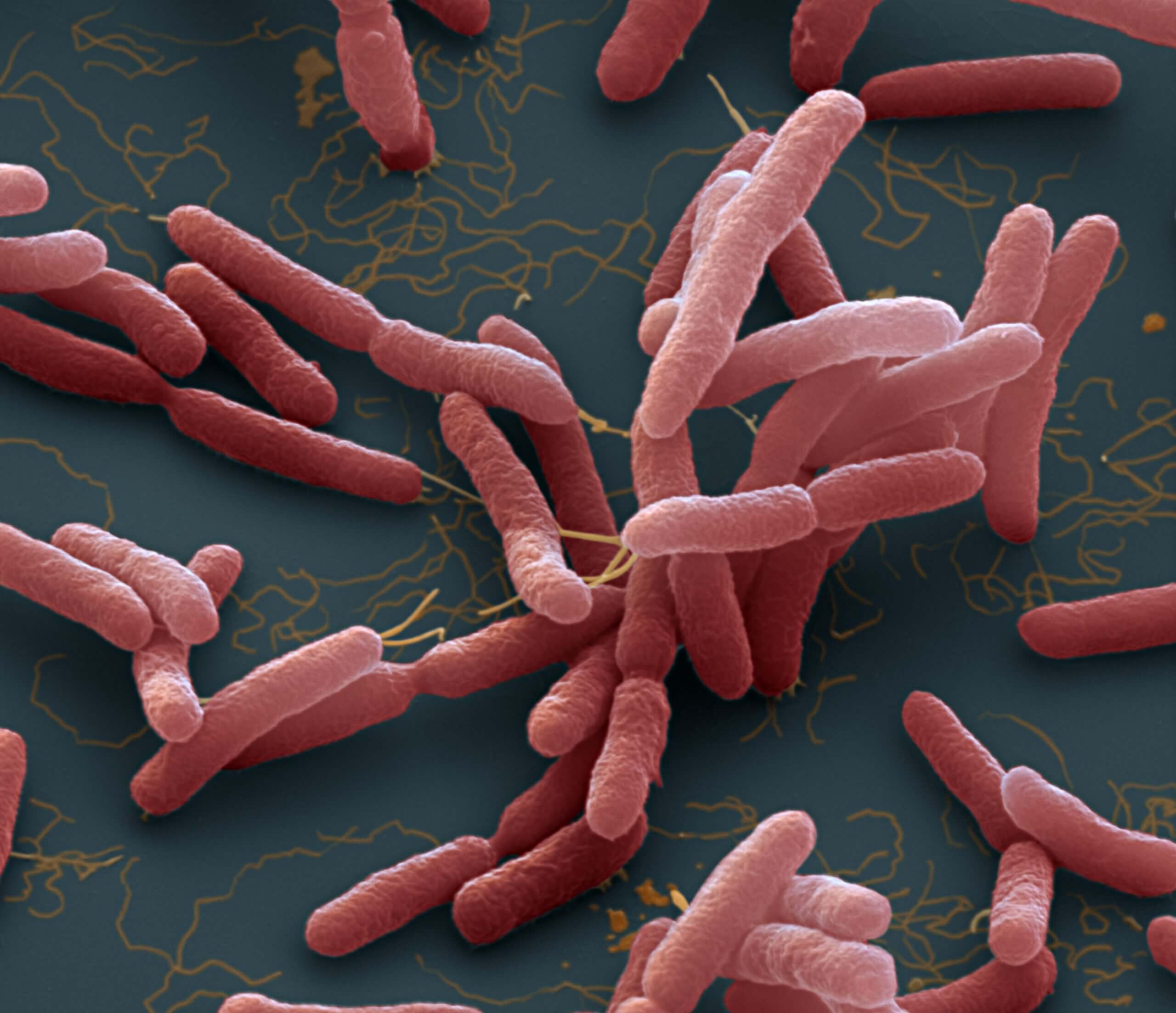 CDC Issues Warning of Deadly Bacteria Coming from the U.S. Gulf Coast ...